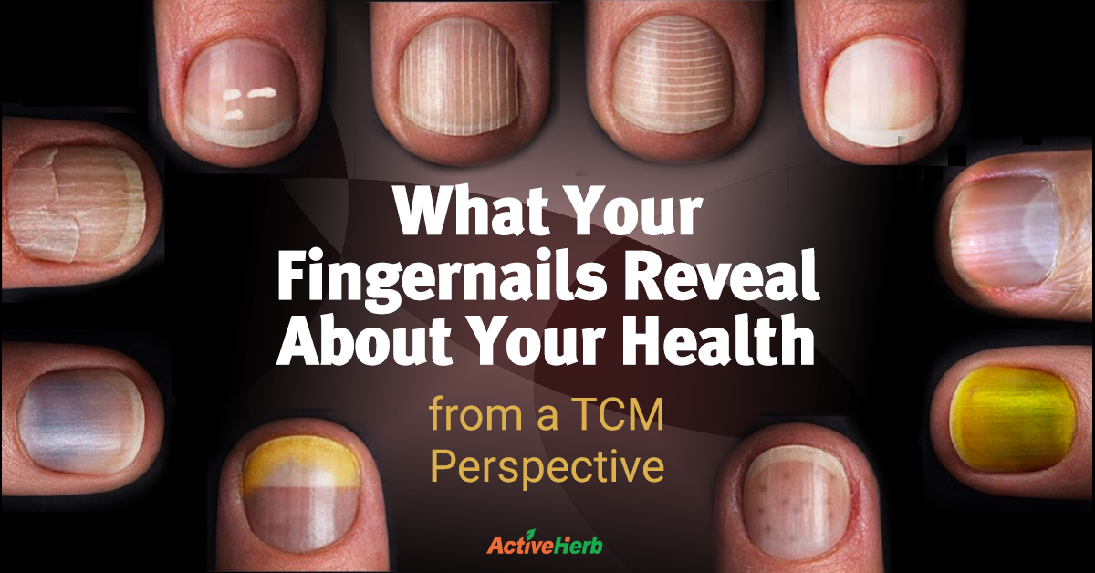 What Your Fingernails Reveal About Your Health According To TCM ...