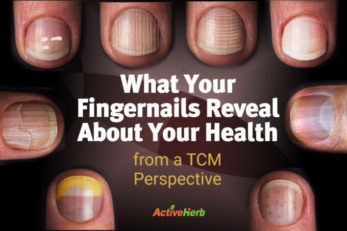 What Your Fingernails Reveal About Your Health According To TCM ...